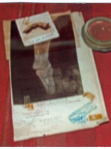 The mummified ‘giant finger’ of Egypt: Did giants once really roam on ...