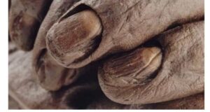 Cloncavan man: A 2,300-year-old murder mystery