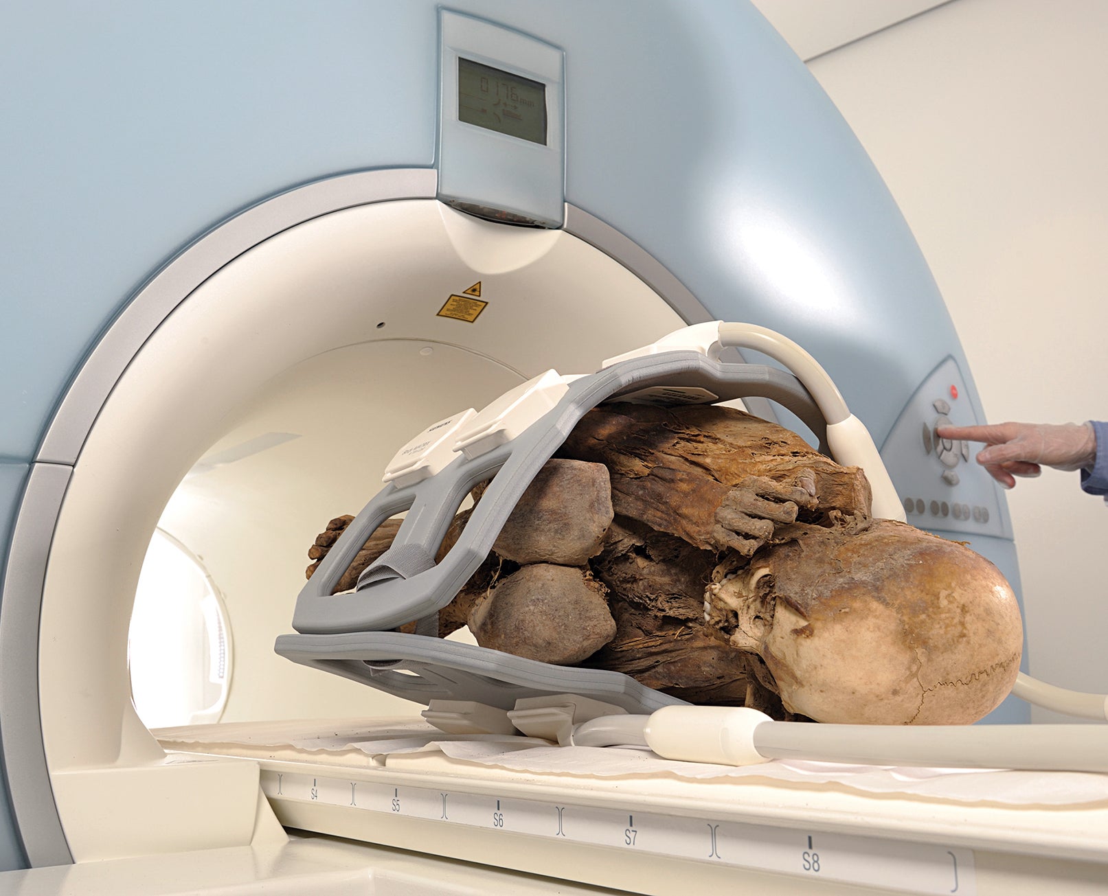 How Studying Mummies Could Cure Modern Diseases